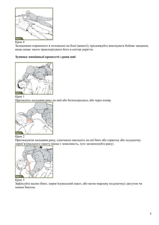 Домедична допомога в умовах бойових дій (В.Д. Юрченко, В.О. Крилюк,) | PDF