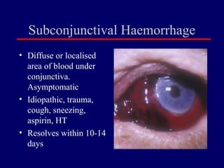 нүд улайх-хам-шинж | PPT