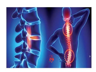 კუნთები | PPTX