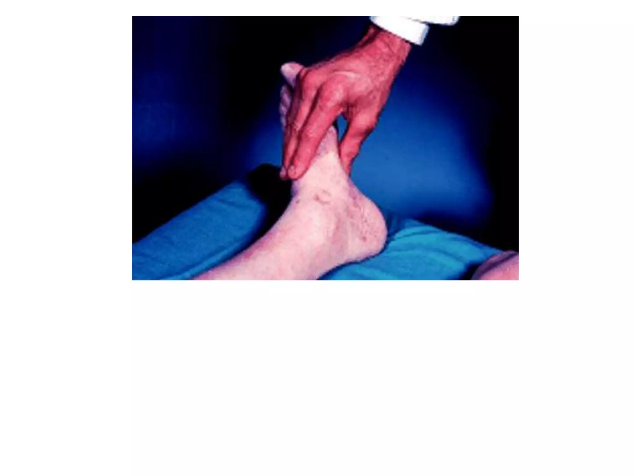 introduction to chronic ischemia | PPTX
