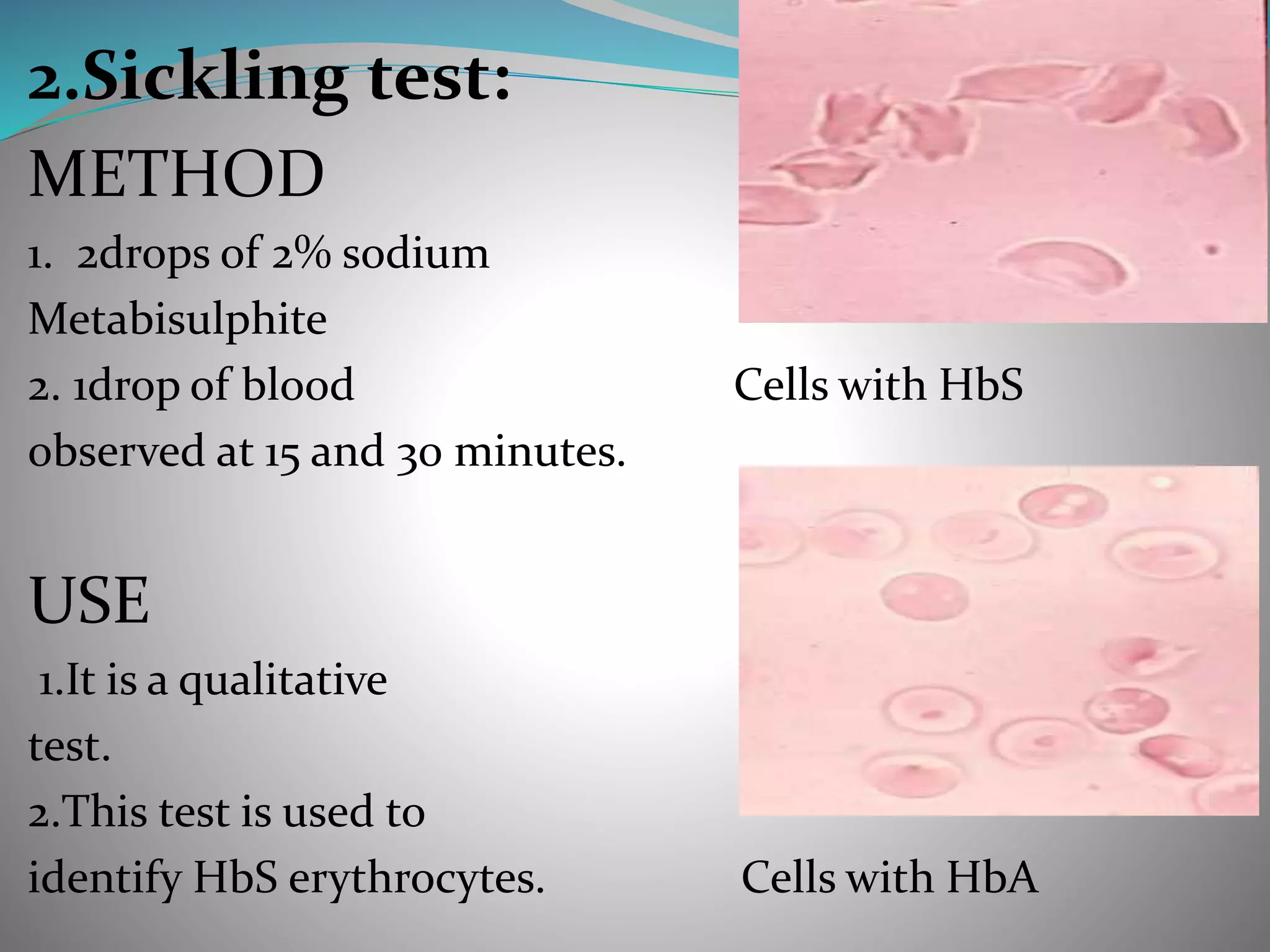 sickel cell anemia | PPTX