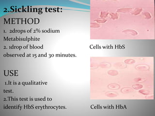 sickel cell anemia | PPTX