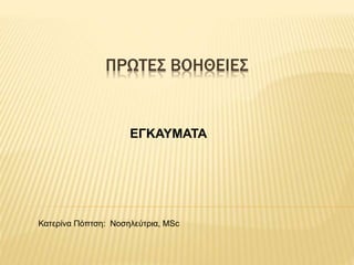 Εγκαύματα | PPTX