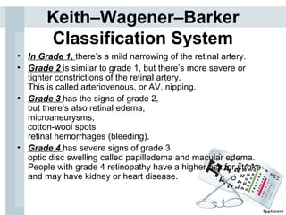 Diabetic retinopathy | PPT
