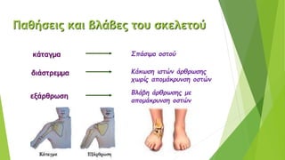 Το μυοσκελετικό σύστημα του ανθρώπου | PPTX