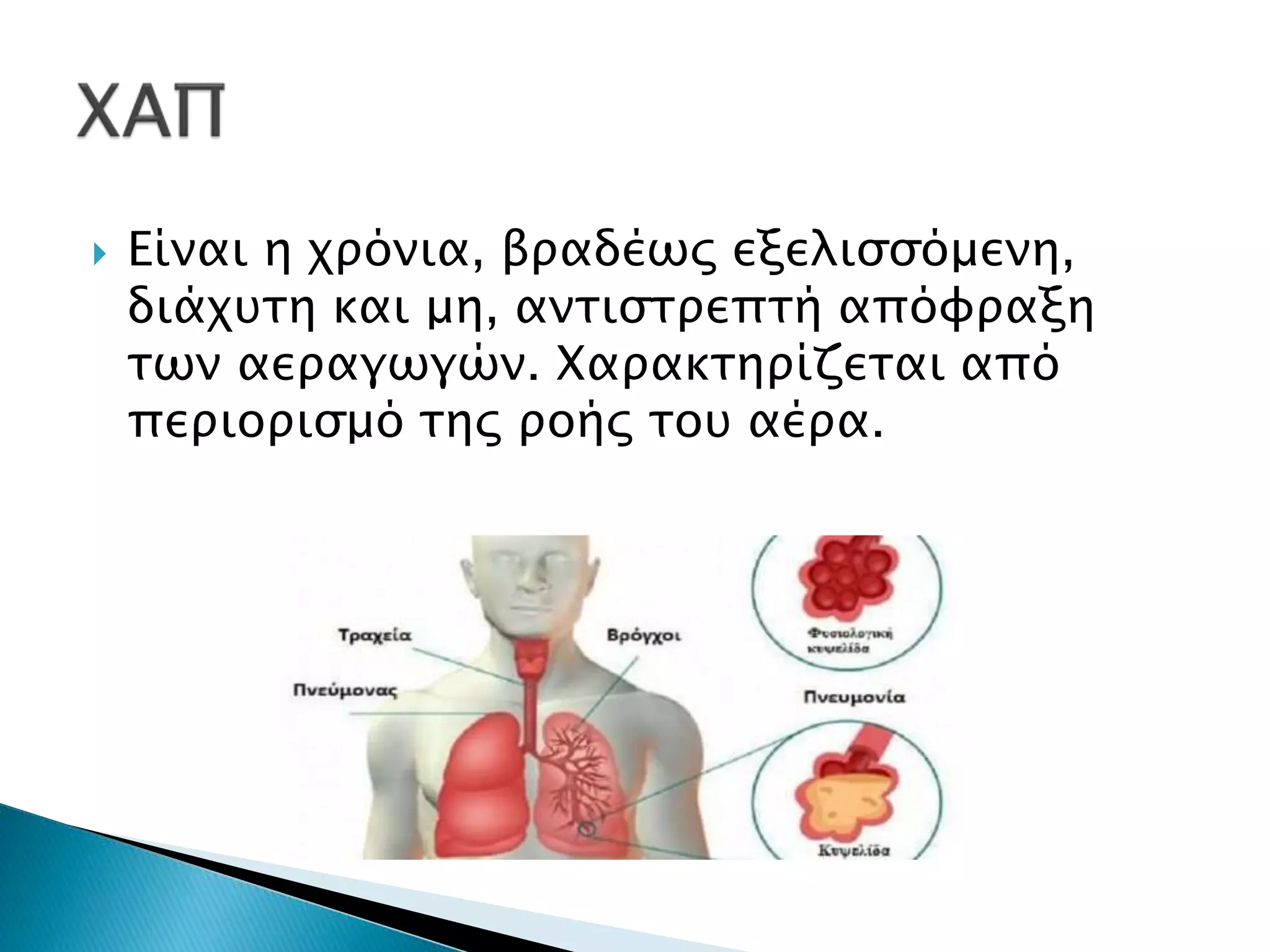 αναπνευστική φυσικοθεραπεία | PPTX