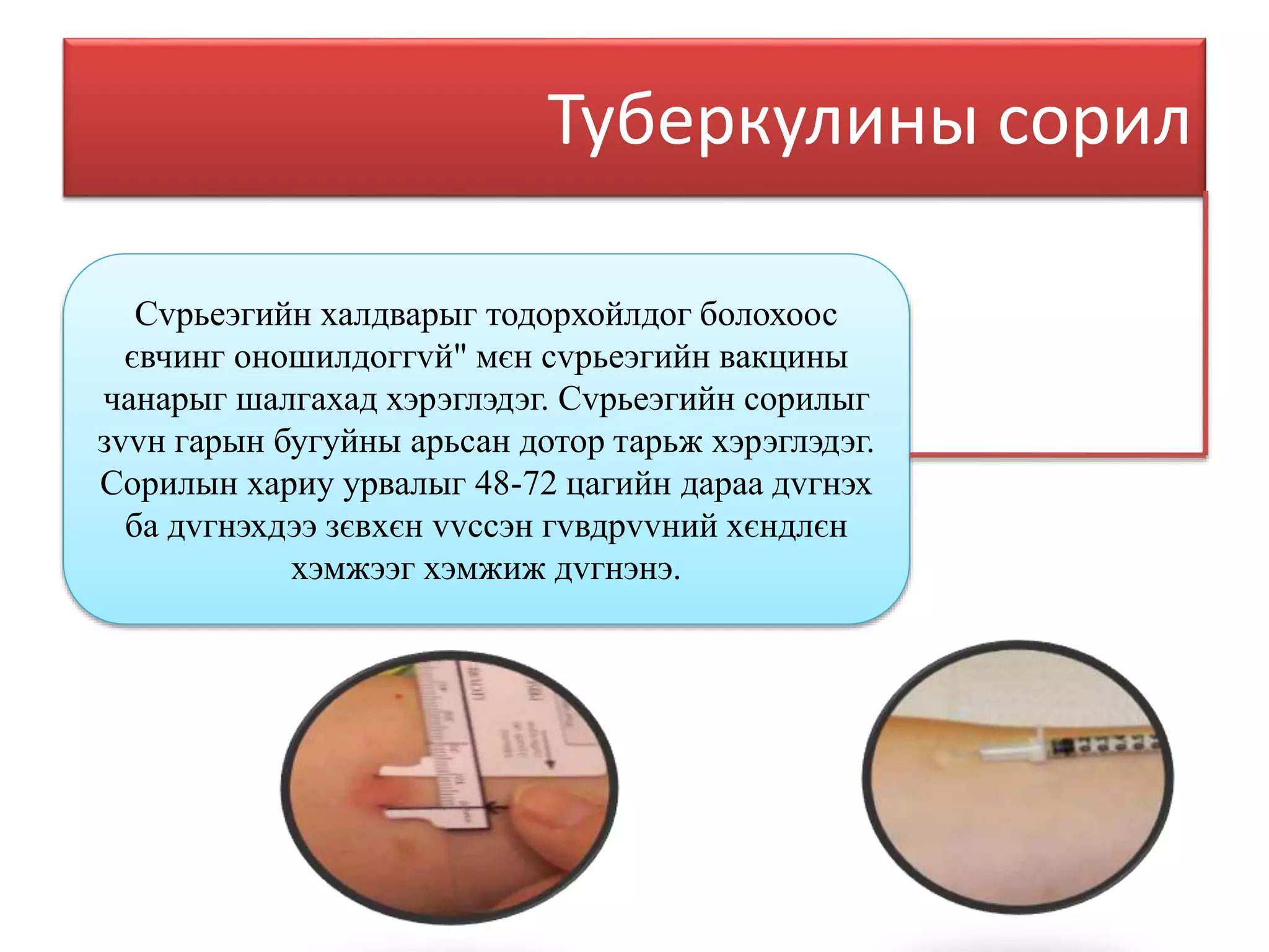 Арьсан доторх тарилга | PPTX