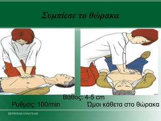 Καρπα | PPT