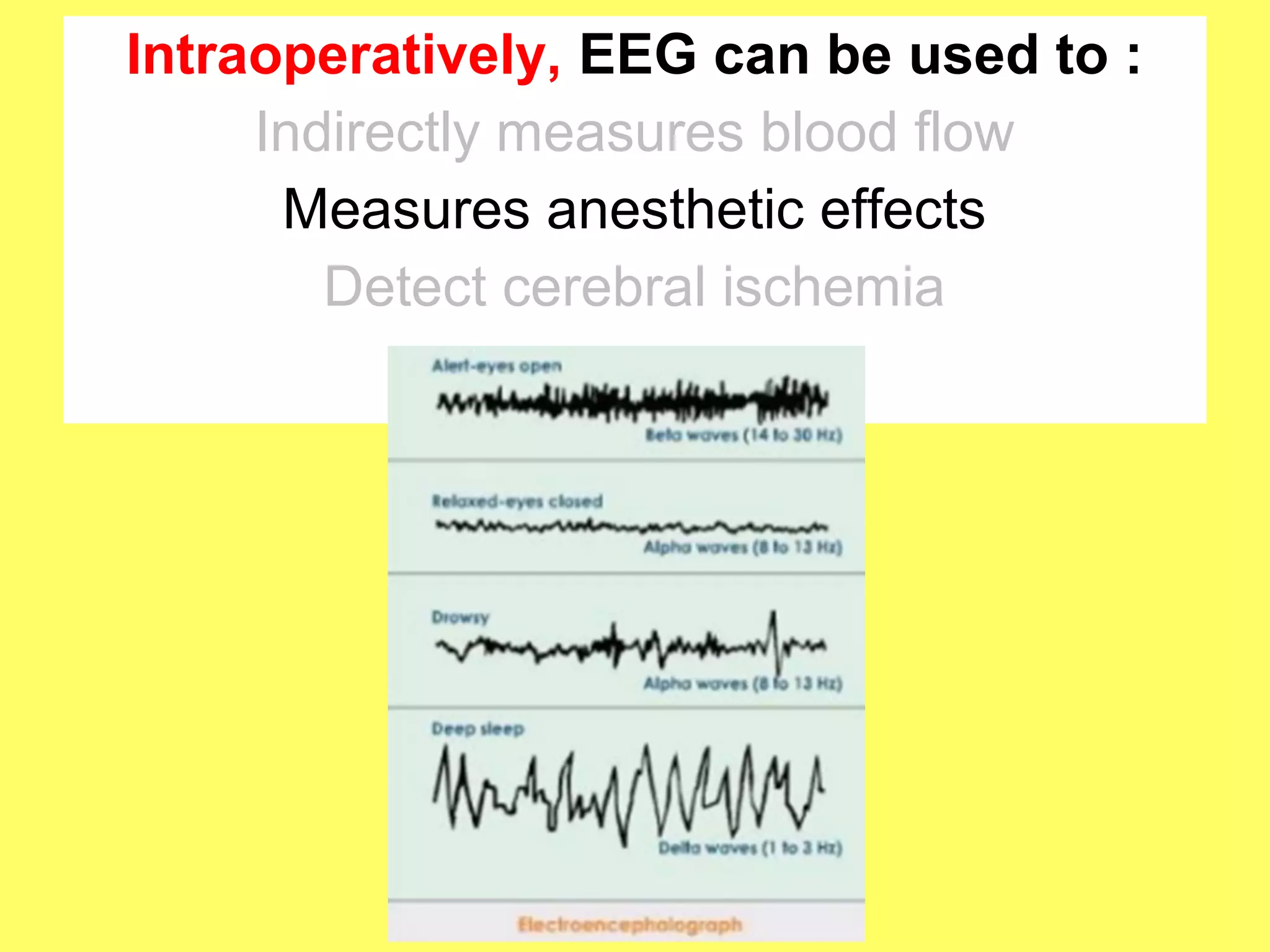 Advances in neuro anesthesia monitoring | PPT