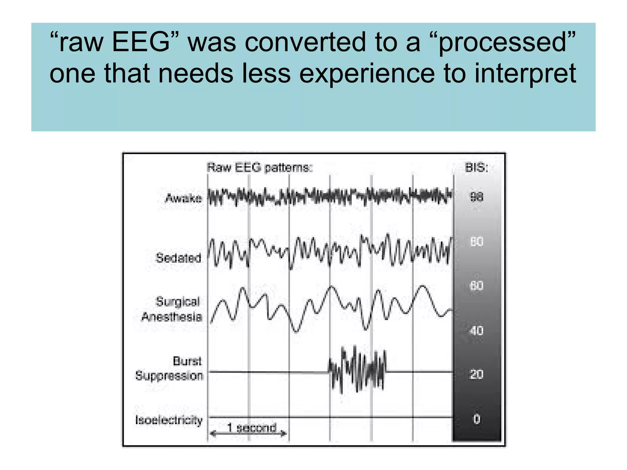 Advances in neuro anesthesia monitoring | PPT