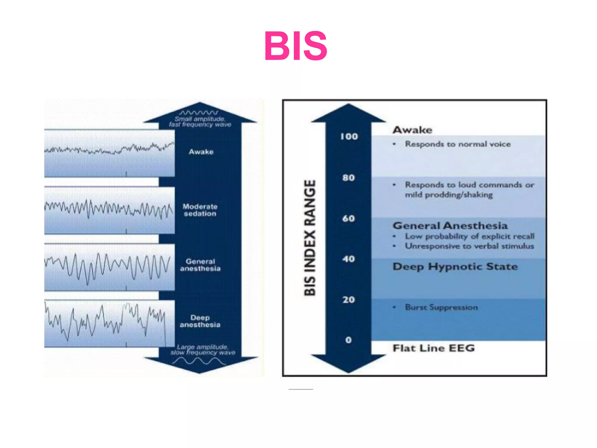 Advances in neuro anesthesia monitoring | PPT