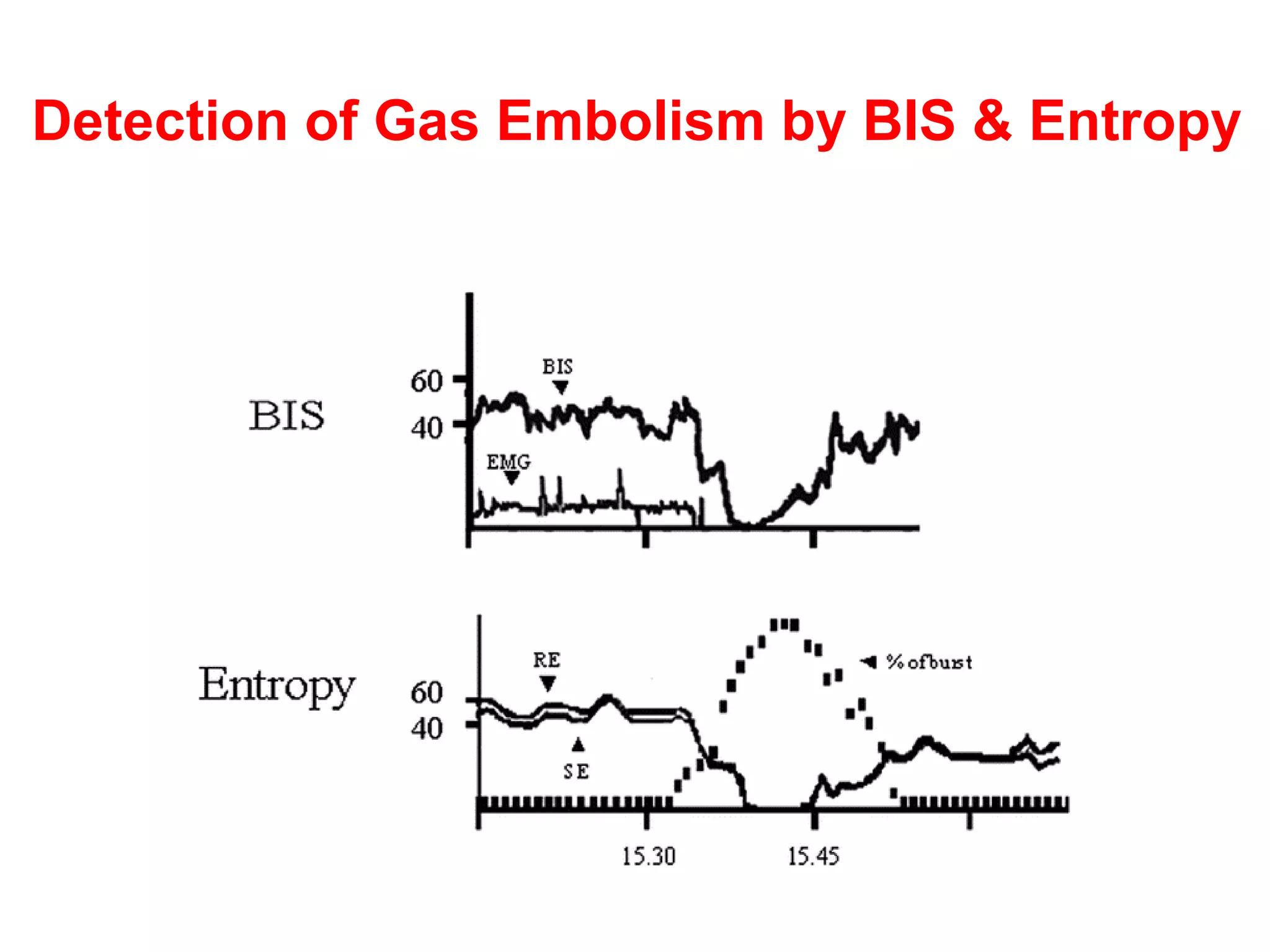 Advances in neuro anesthesia monitoring | PPT