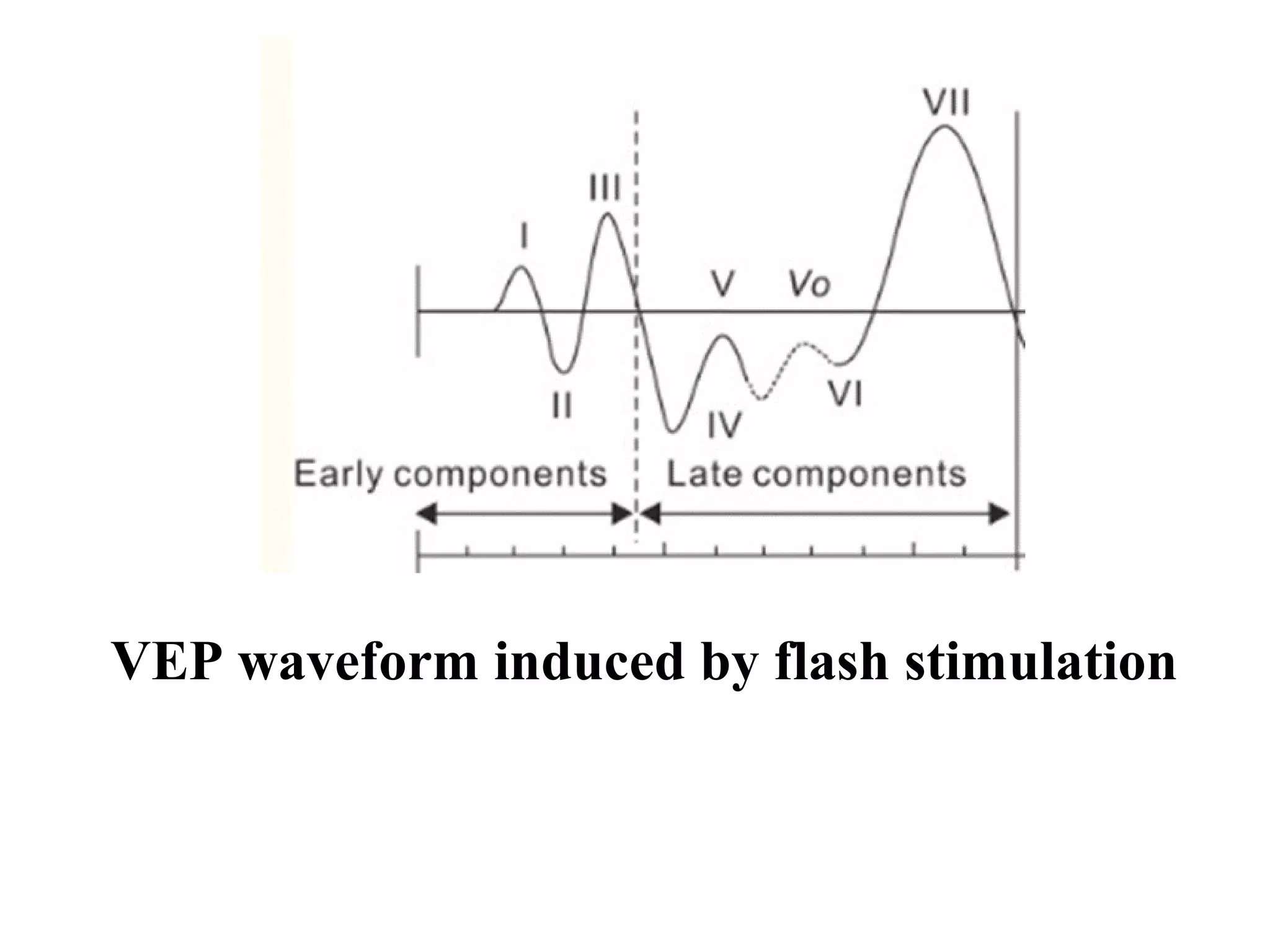 Advances in neuro anesthesia monitoring | PPT