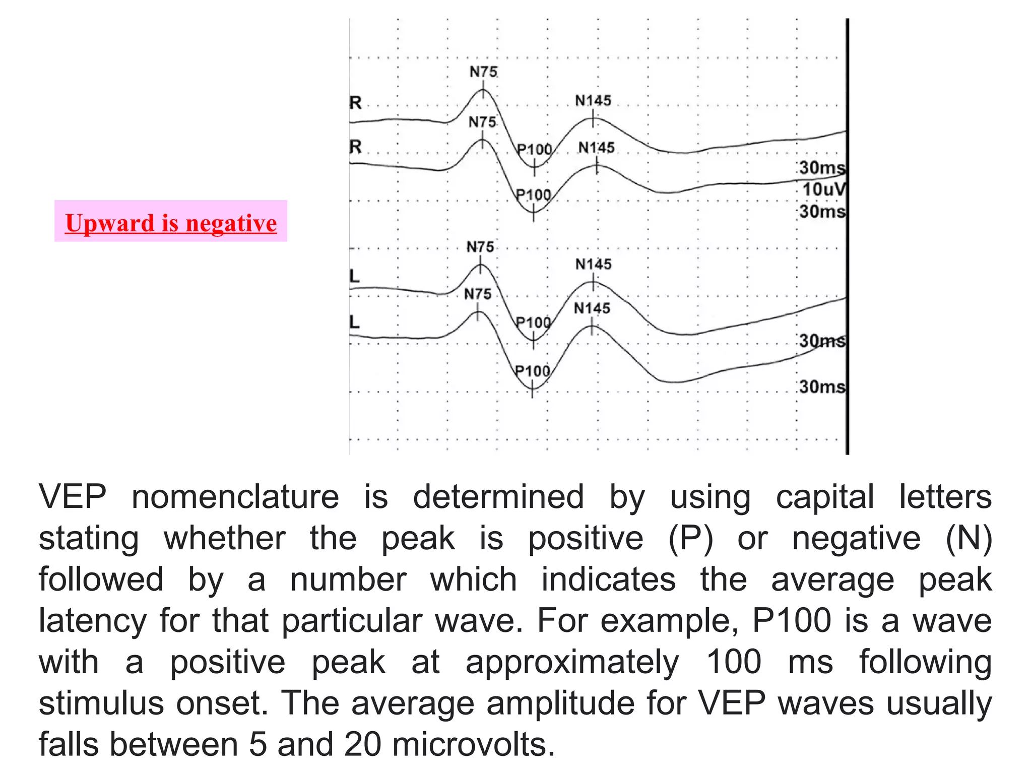 Advances in neuro anesthesia monitoring | PPT