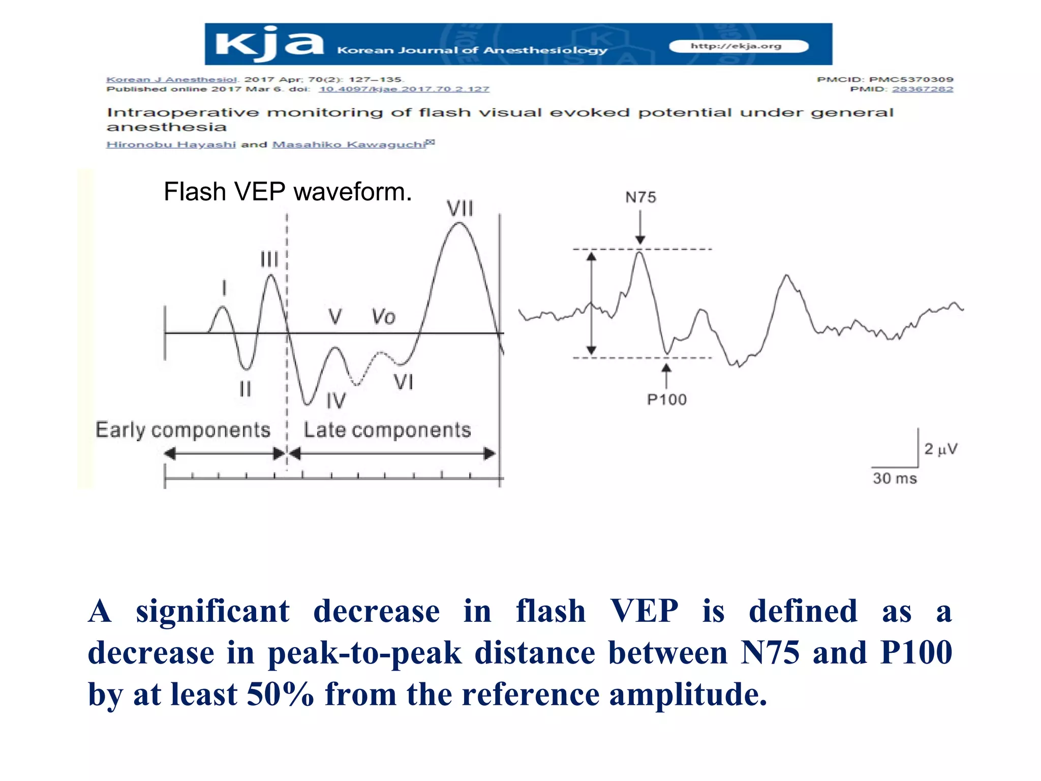 Advances in neuro anesthesia monitoring | PPT