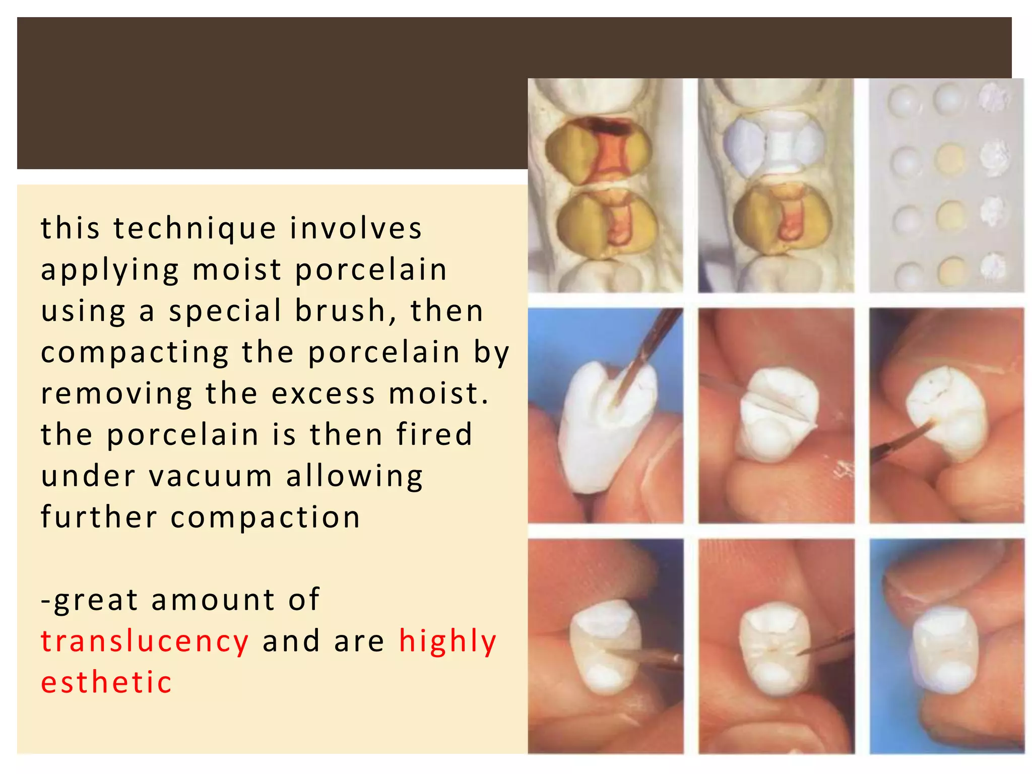 Basic Principles of crowns & bridges | PPTX