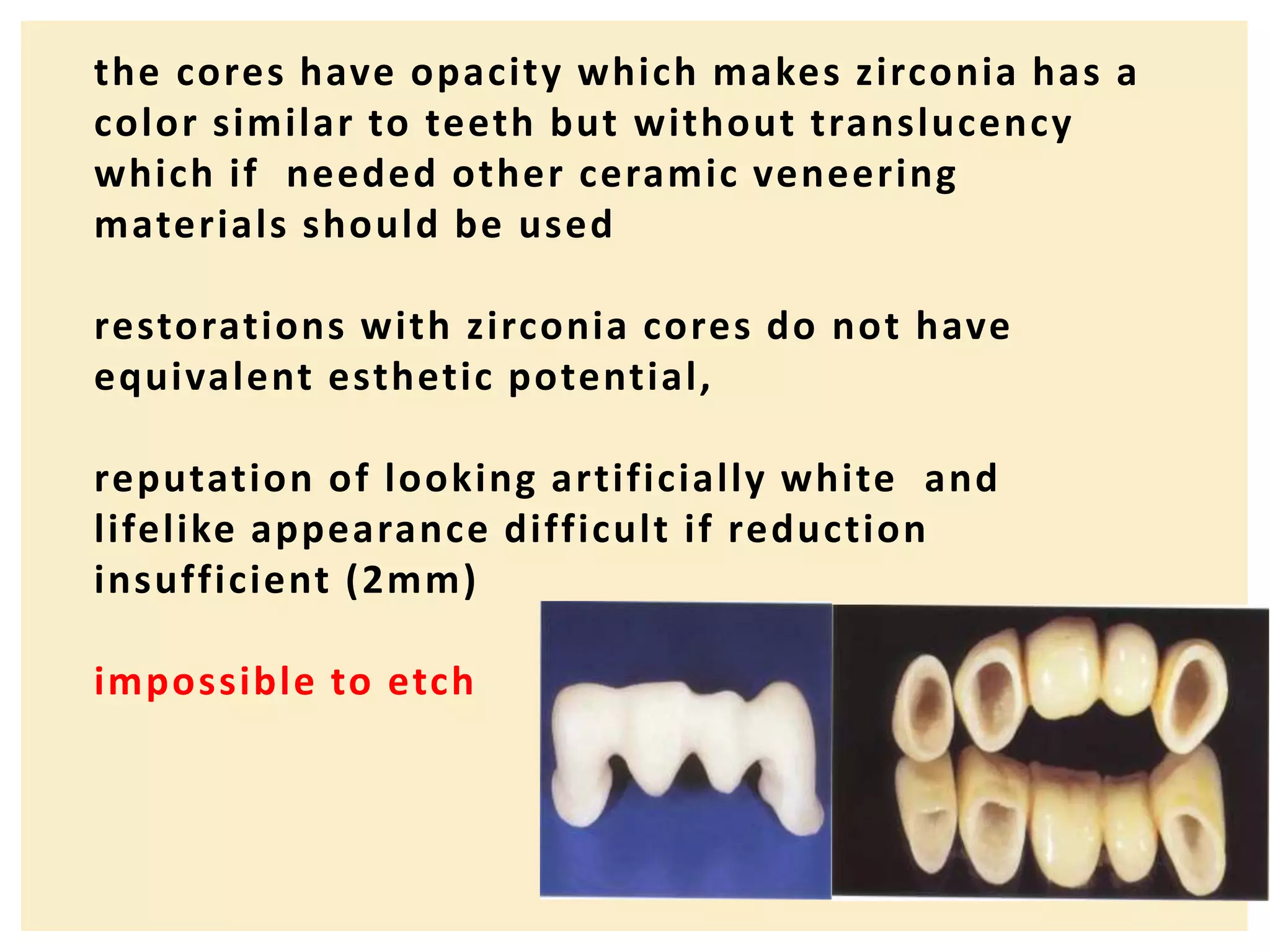 Basic Principles of crowns & bridges | PPTX