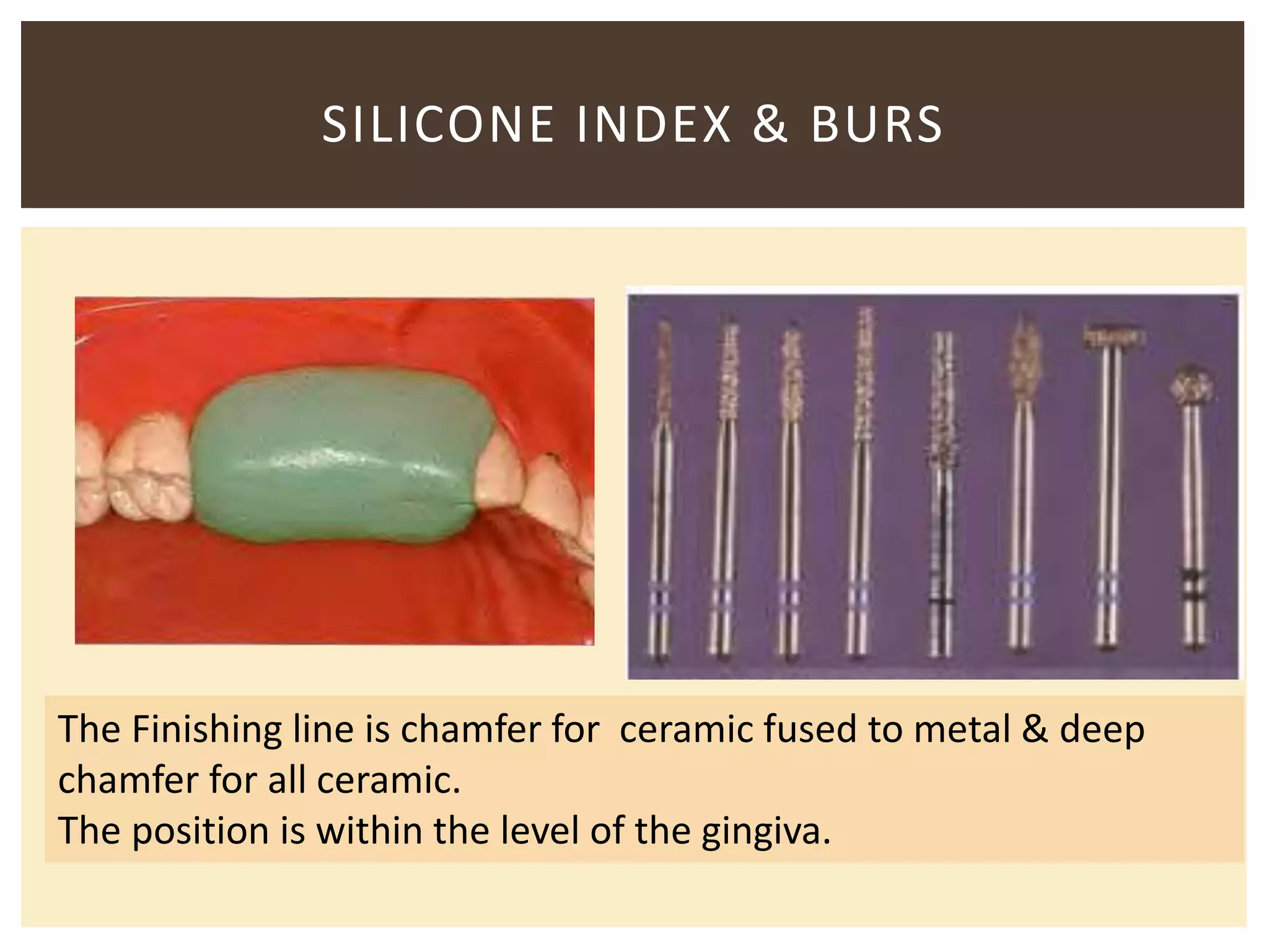 Basic Principles of crowns & bridges | PPTX