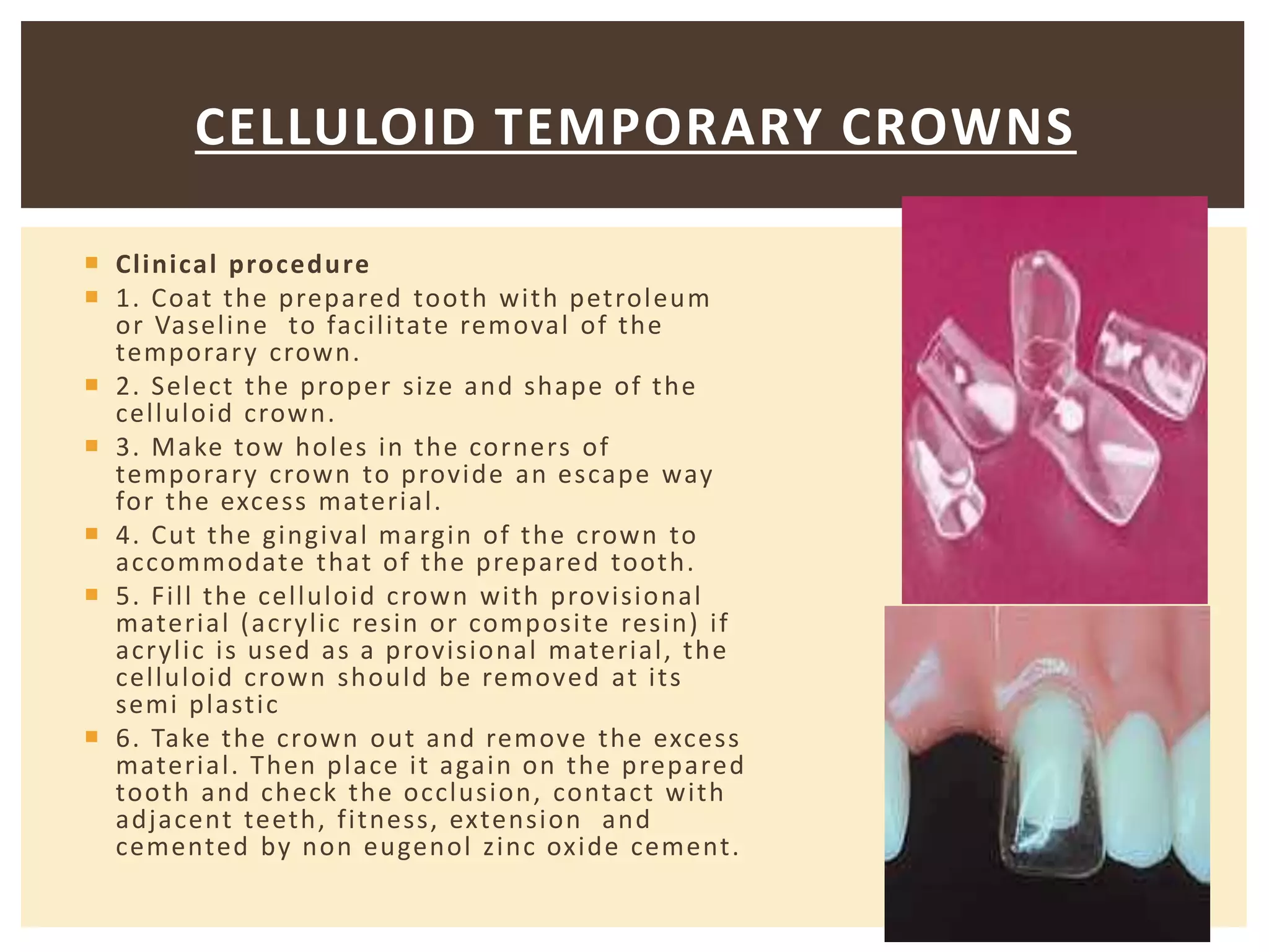 Basic Principles of crowns & bridges | PPTX