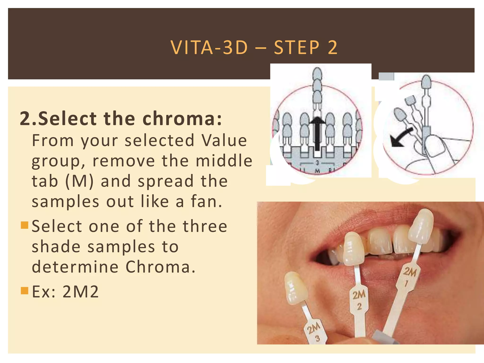 Basic Principles of crowns & bridges | PPTX