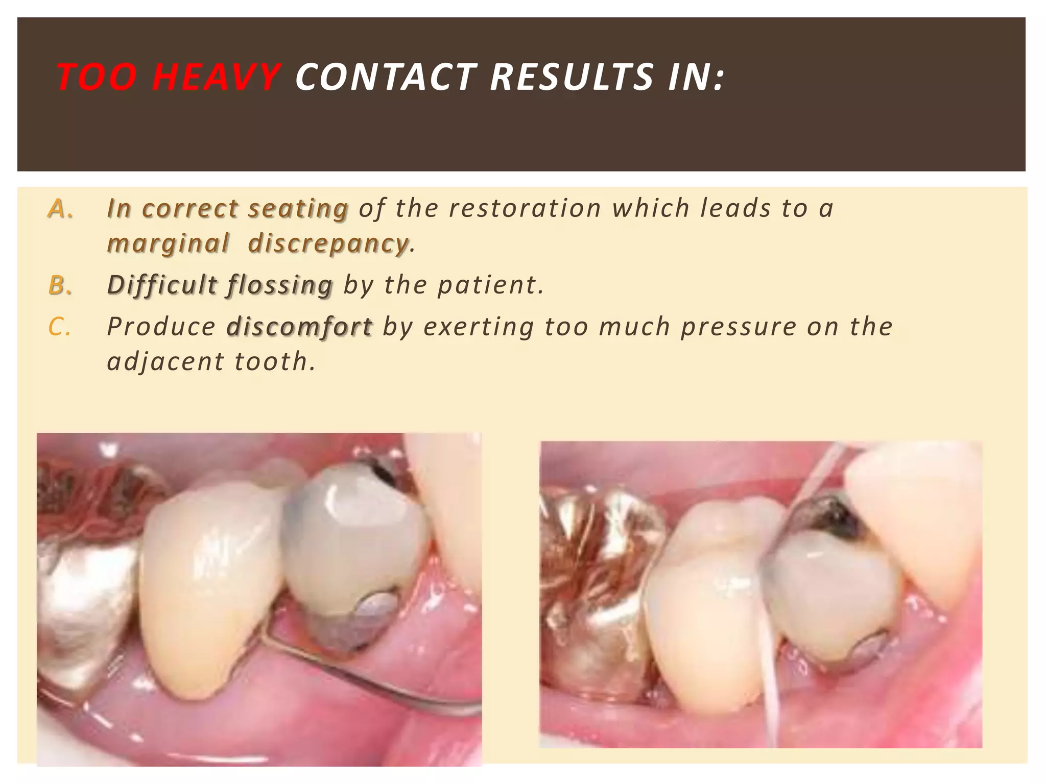 Basic Principles of crowns & bridges | PPTX