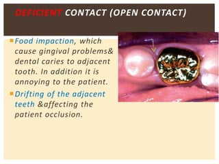 Basic Principles of crowns & bridges | PPTX