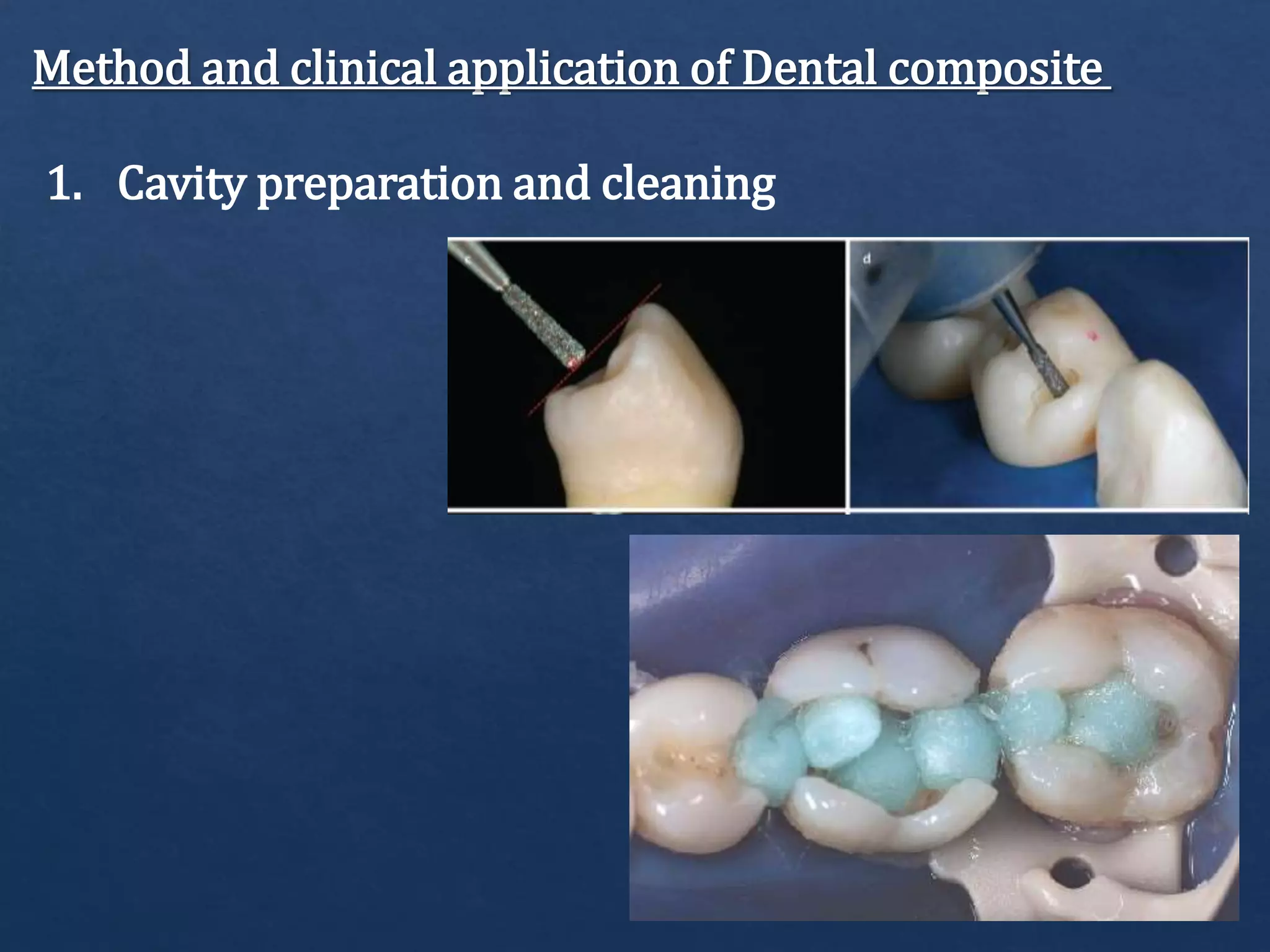 Dental Composite | PPTX