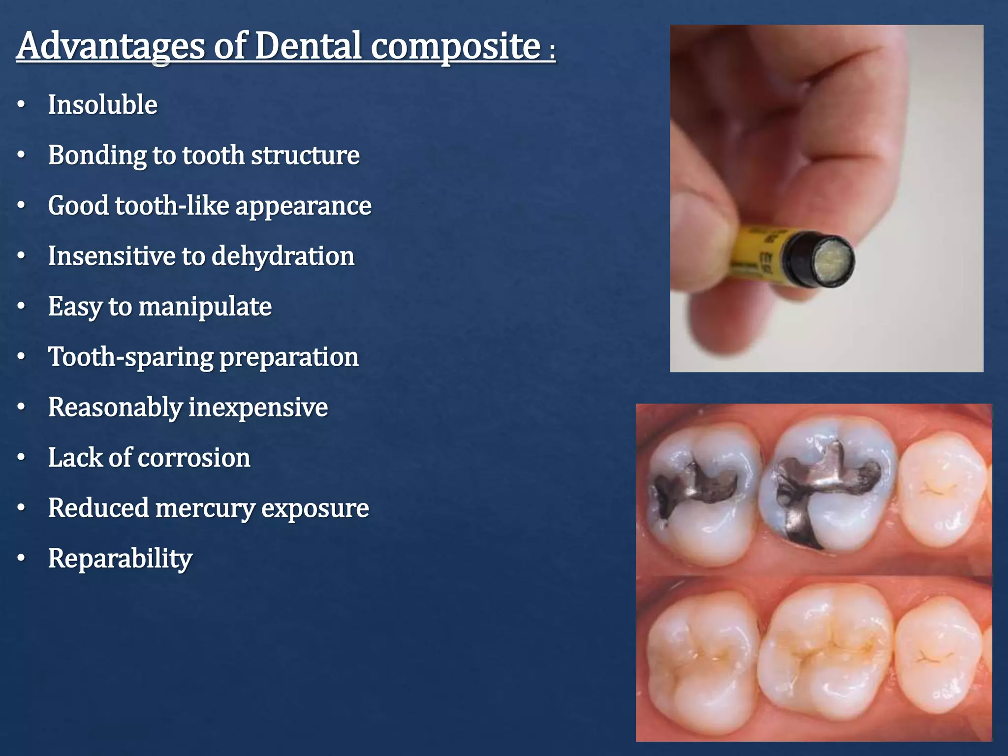 Dental Composite | PPTX