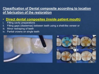 Dental Composite | PPTX