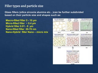 Dental Composite | PPTX