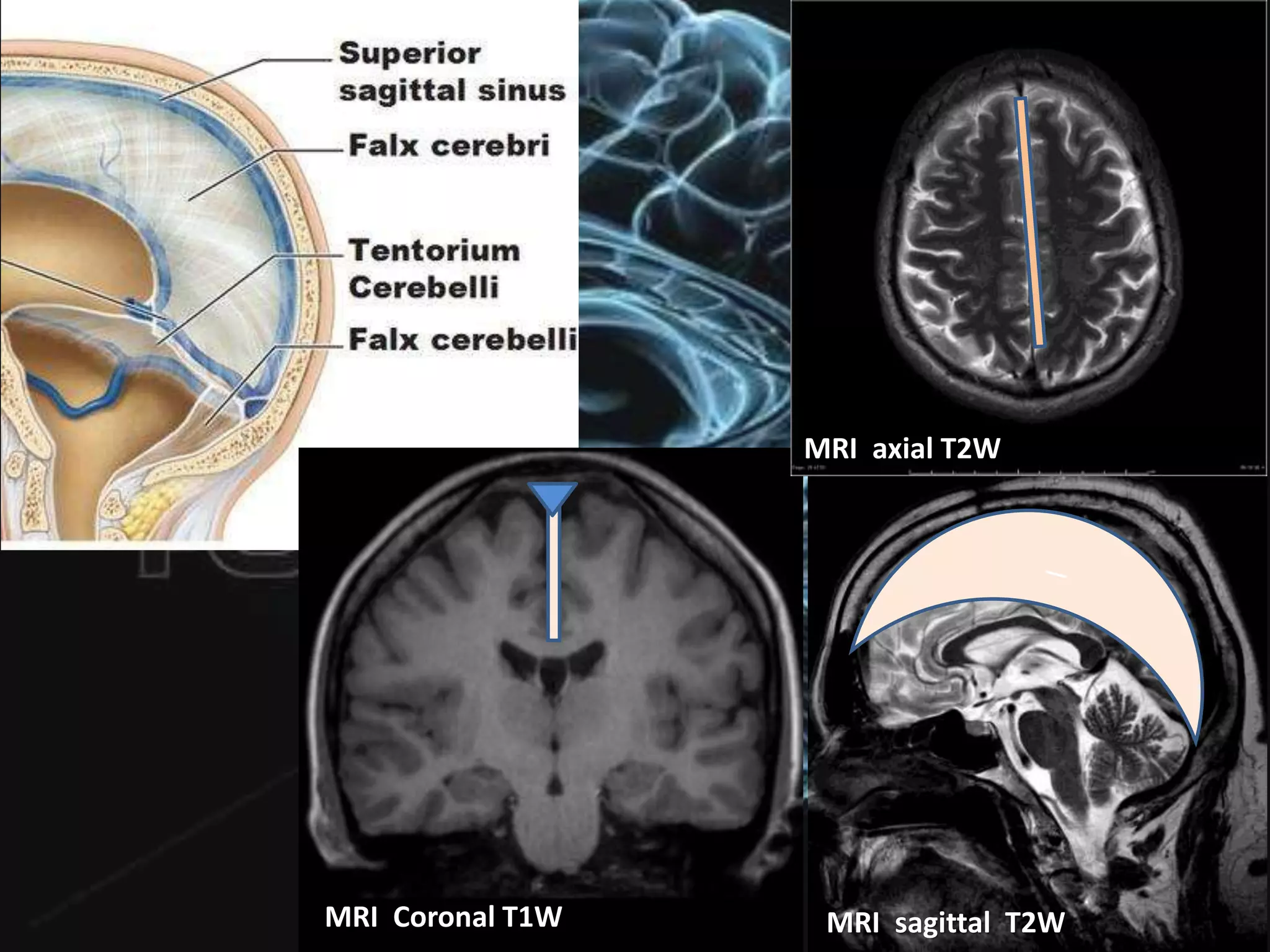 Anatomical Radiological Integrated Course: PART I: Subarachnoid ...