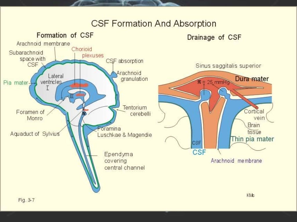 Anatomical Radiological Integrated Course: PART I: Subarachnoid Ciste…