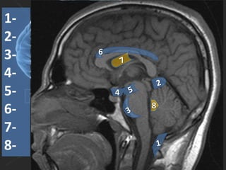 Anatomical Radiological Integrated Course: PART I: Subarachnoid ...