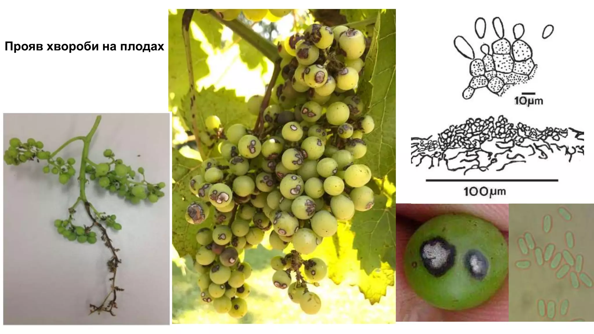 Хвороби винограду. Мікози / Fungal diseases of grapevine | PPTX