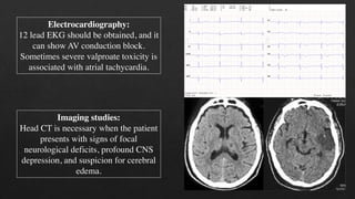 Valproic Acid Toxicity | PDF