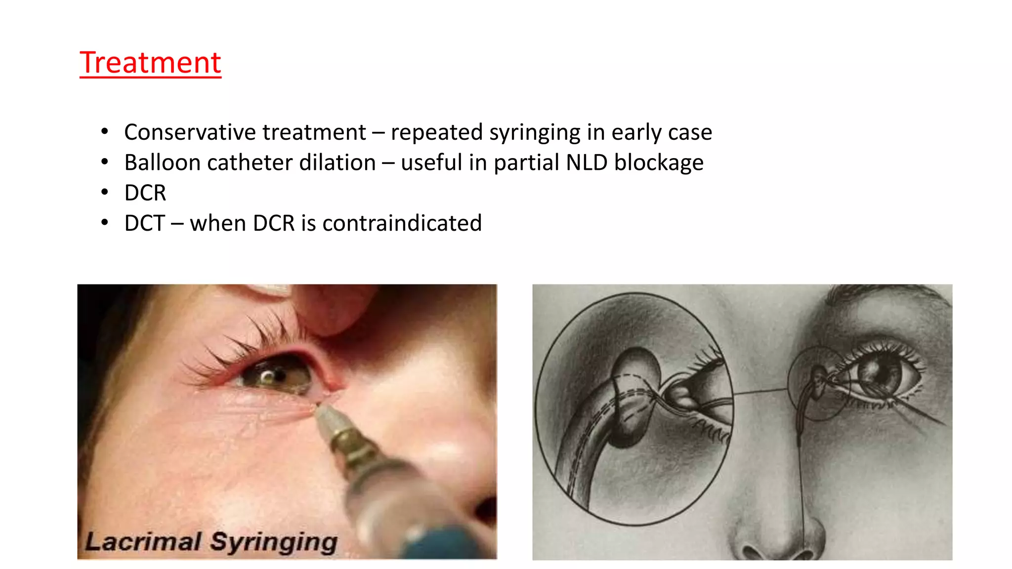 संधि गत रोग.pptx