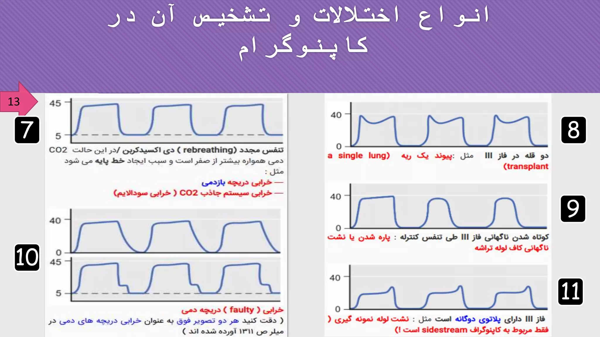 Monitoring Anesthesia Pptx