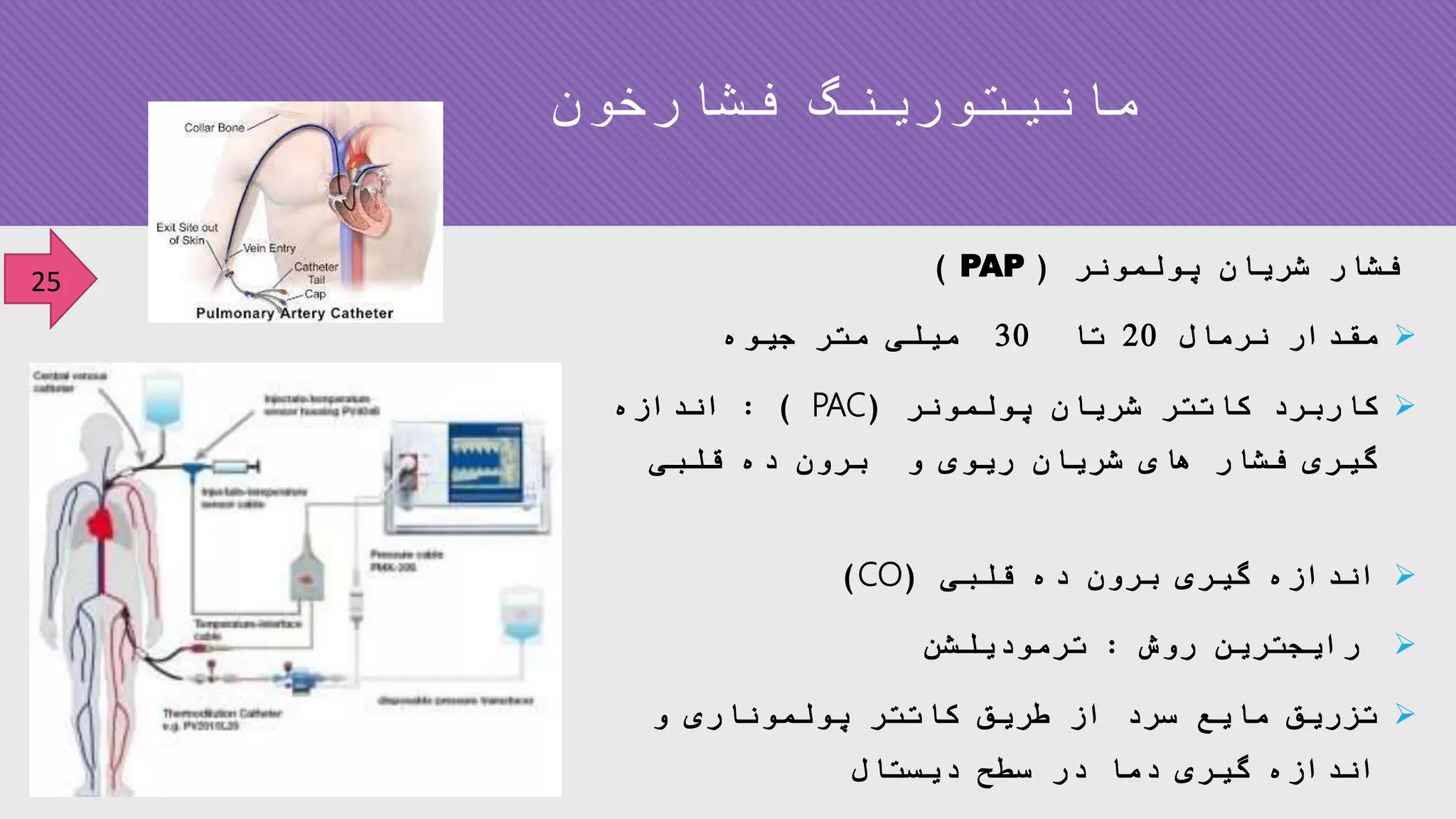 Monitoring Anesthesia Pptx