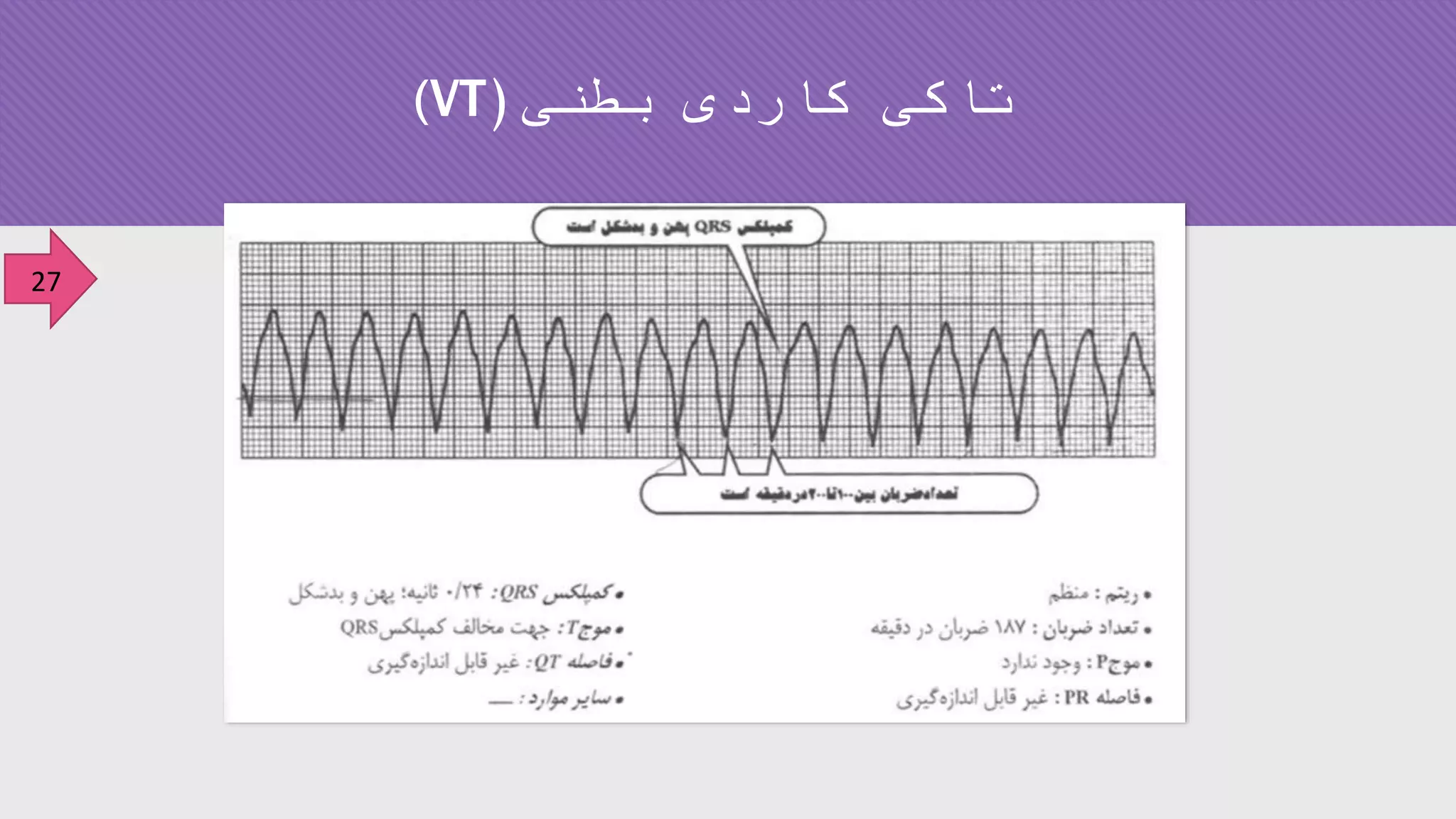 Monitoring Anesthesia Pptx