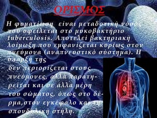 ΦΥΜΑΤΙΩΣΗ.pptx