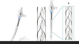 Endodontics Instruments | PPT