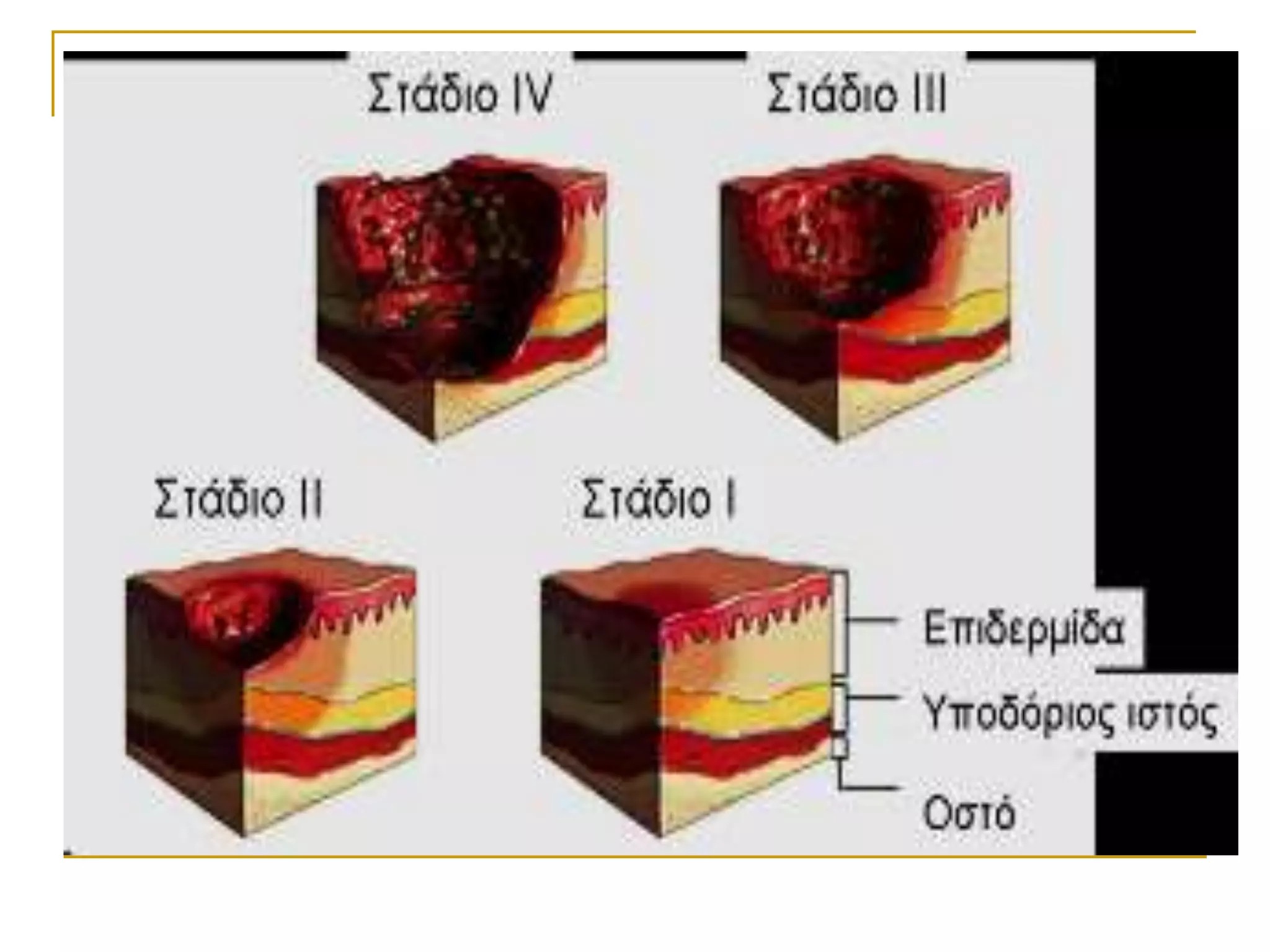 ΚΑΤΑΚΛΙΣΕΙΣ.pptx