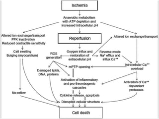 Классификация ишемий при АН.pptx