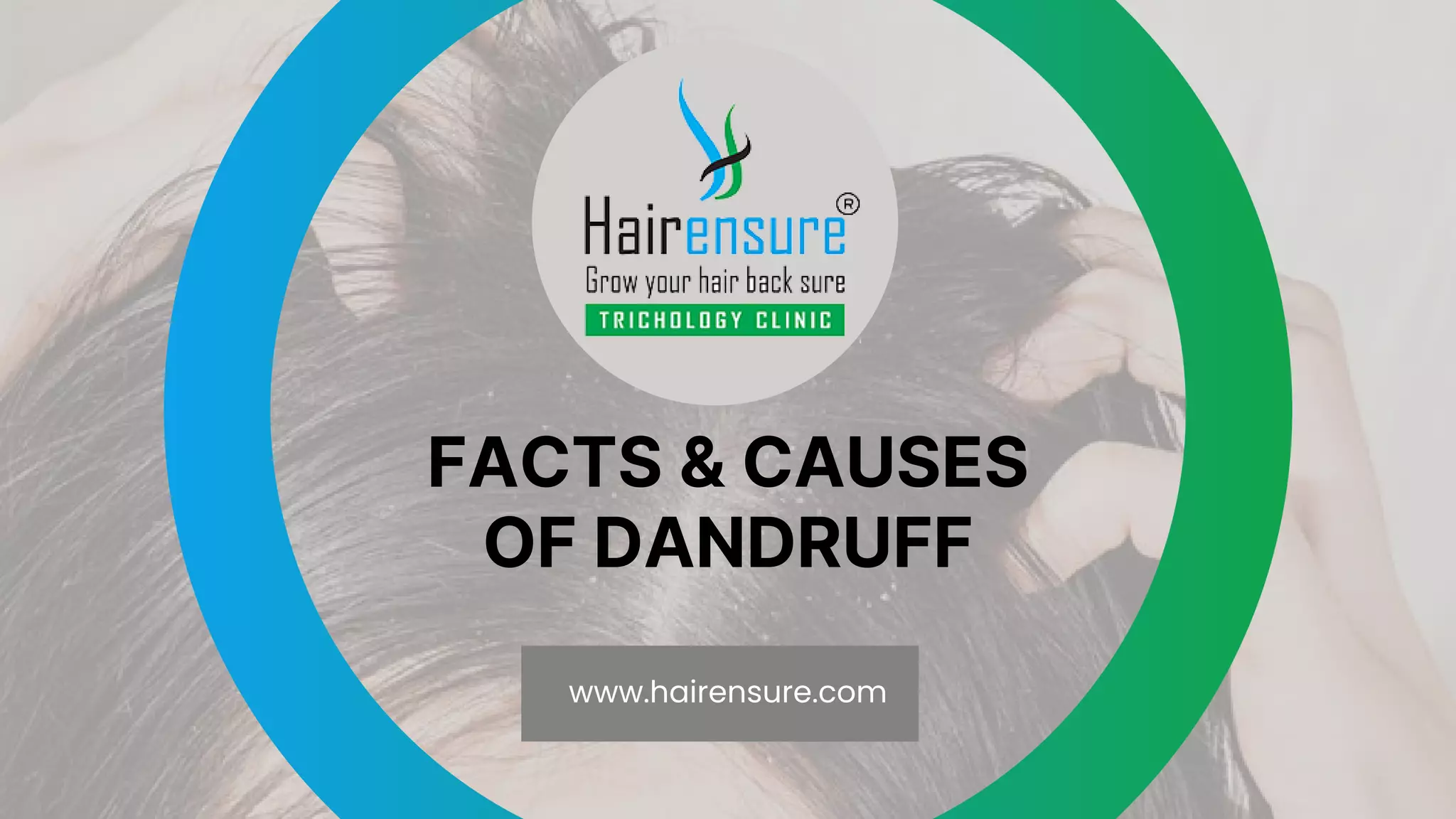 Facts and Causes of Dandruff | Hair Ensure | PDF