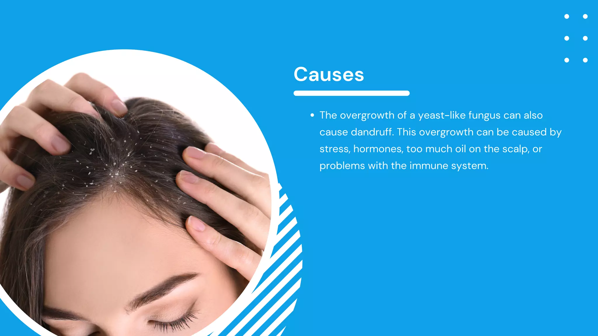 Facts and Causes of Dandruff | Hair Ensure | PDF