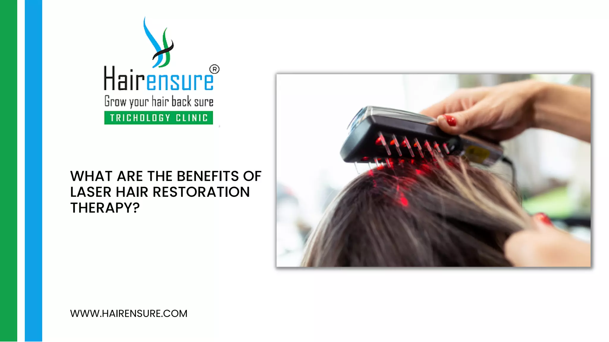 What are the benefits of laser hair restoration therapy? | Hair Ensure ...