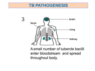 Pulmonary Tuberculosis.pptx
