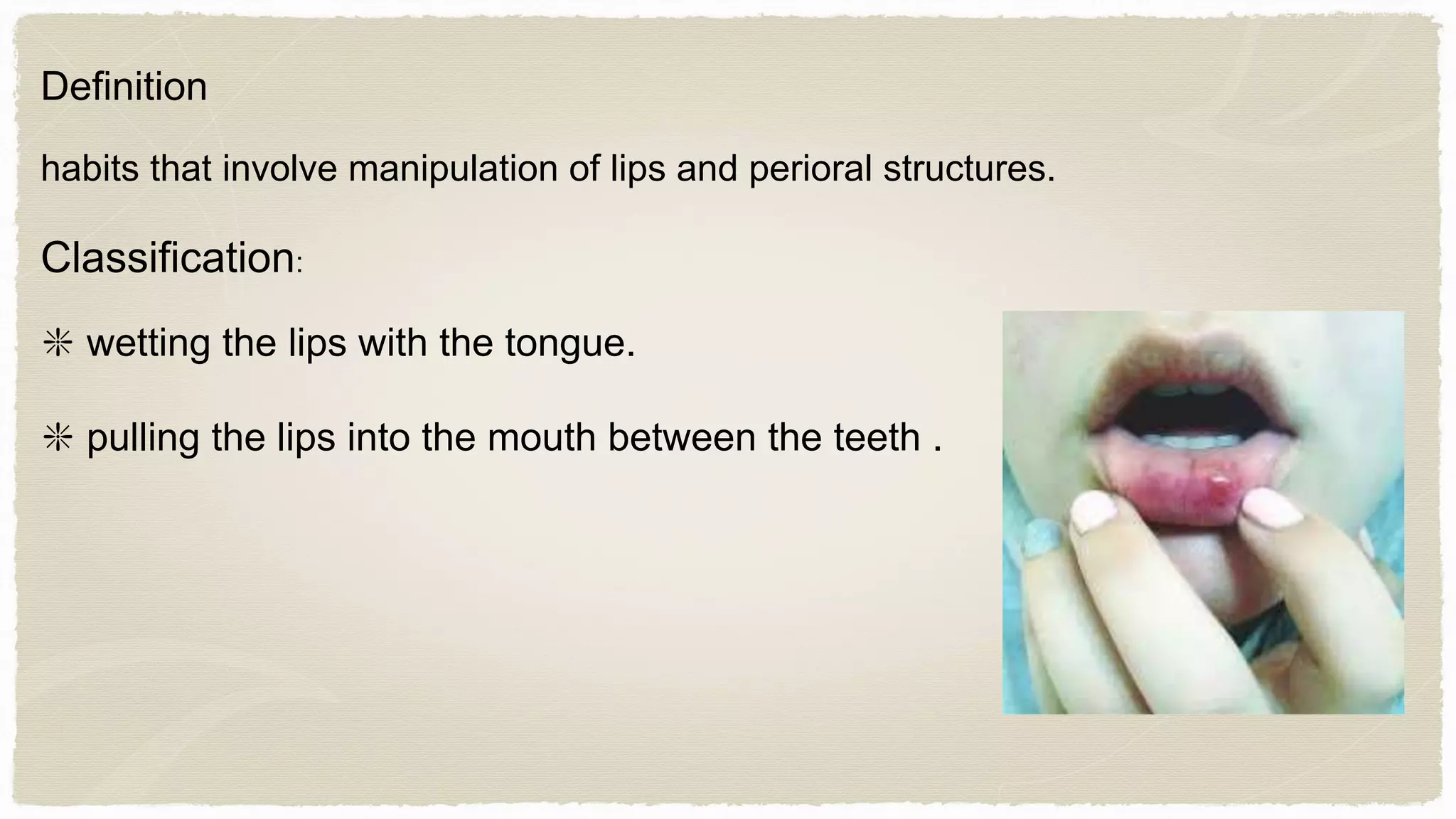 Bad oral habits | PPTX