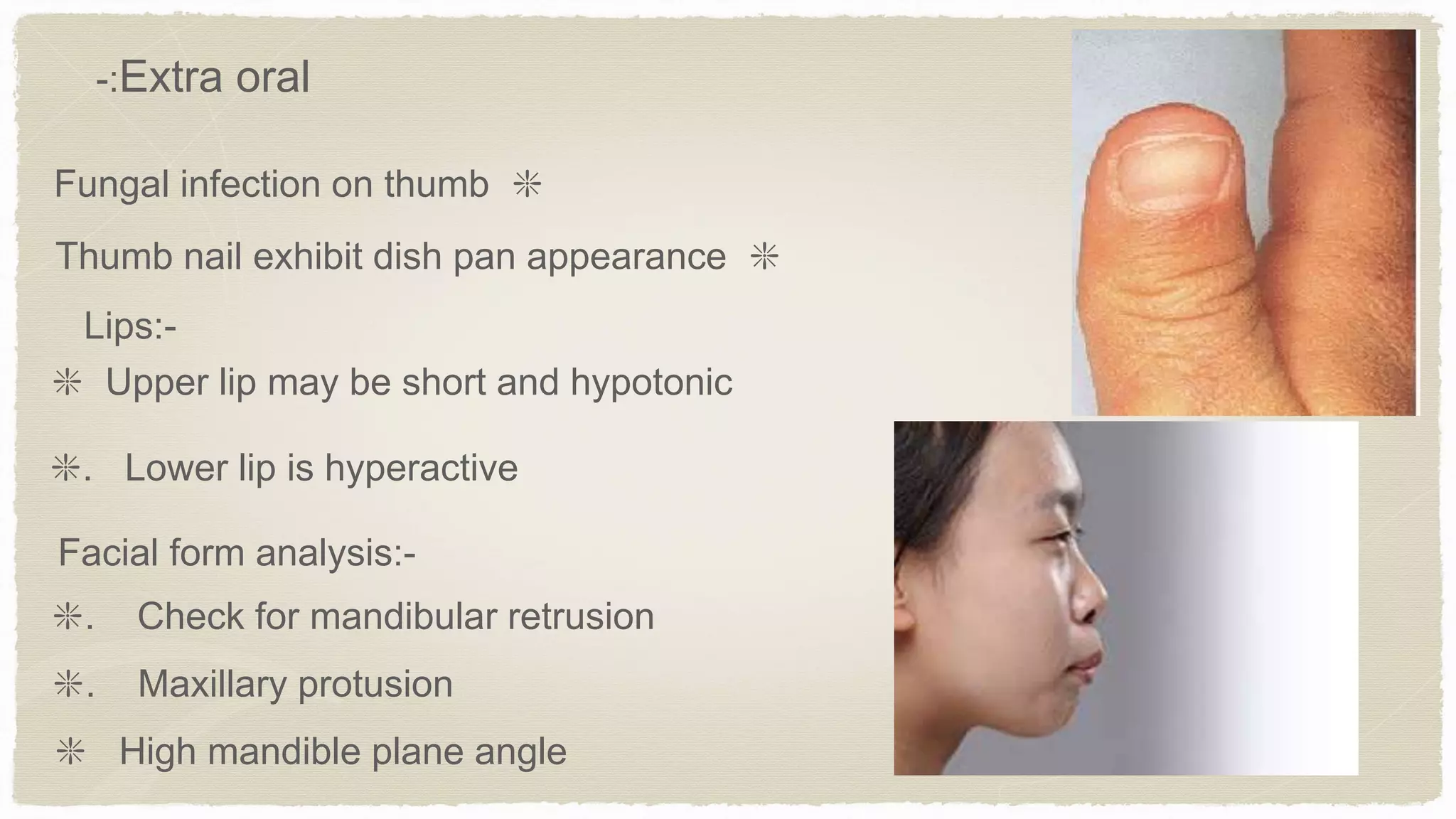 Bad oral habits | PPTX