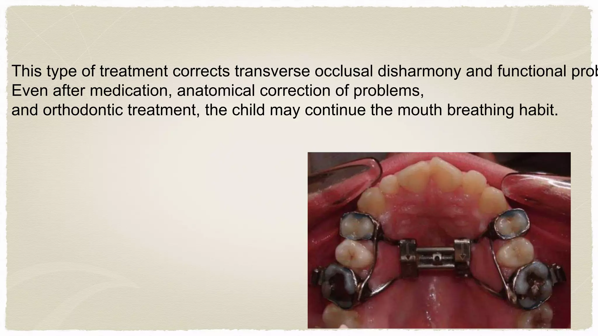 Bad oral habits | PPTX